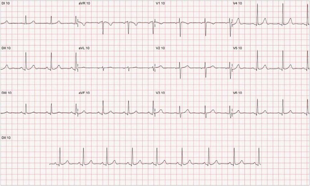 ECGNOW Telecardiologia ECGNOW Telecardiologia