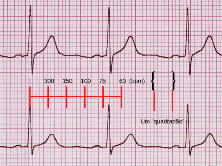 ECGNOW Telecardiologia ecgnow-telecardiologia